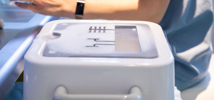 New Horizons in Fertility Treatment: Ovarian Tissue Cryopreservation ...